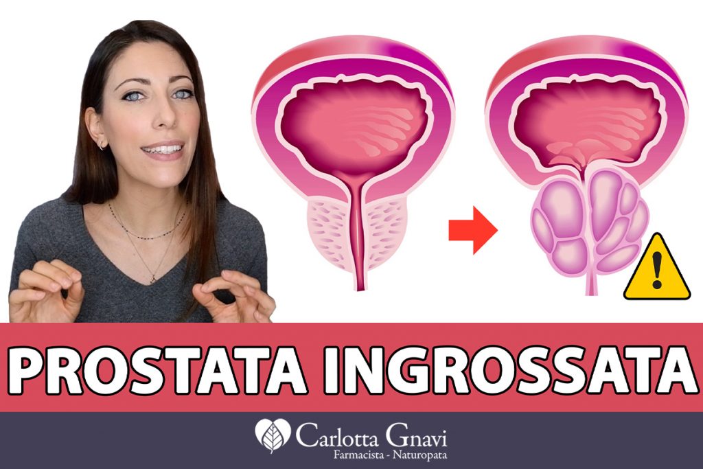 L' ipertrofia prostatica benigna - Carlotta Gnavi | Health Coach ...